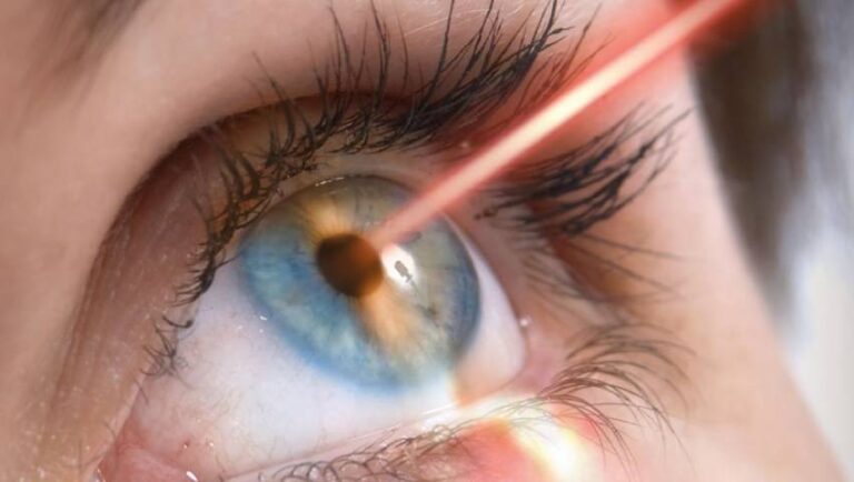 Clearing Up Misconceptions: What to Know Before Considering LASIK Eye Surgery - Clairevision Eye ...