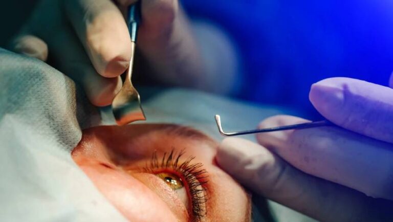 Types of Cataract Surgery: Traditional vs. Laser-Assisted ...